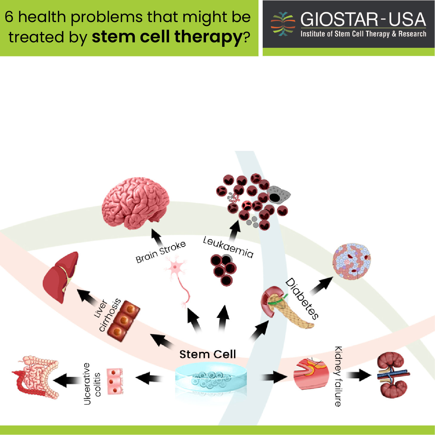 What are 6 health problems that might be treated by stem cells? - GIOSTAR