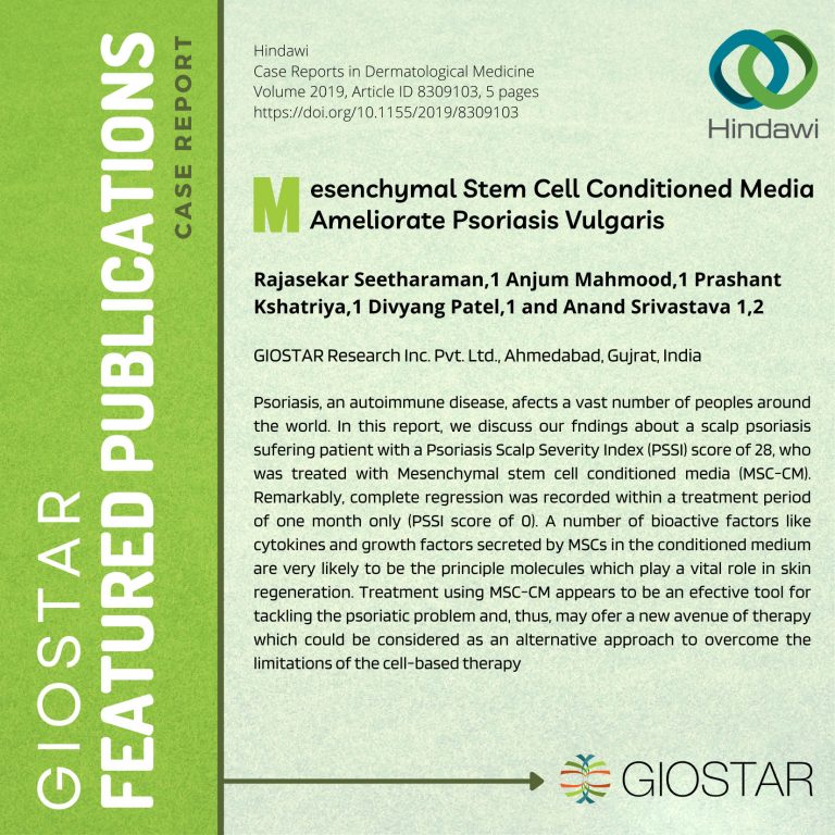 GIOSTAR USA